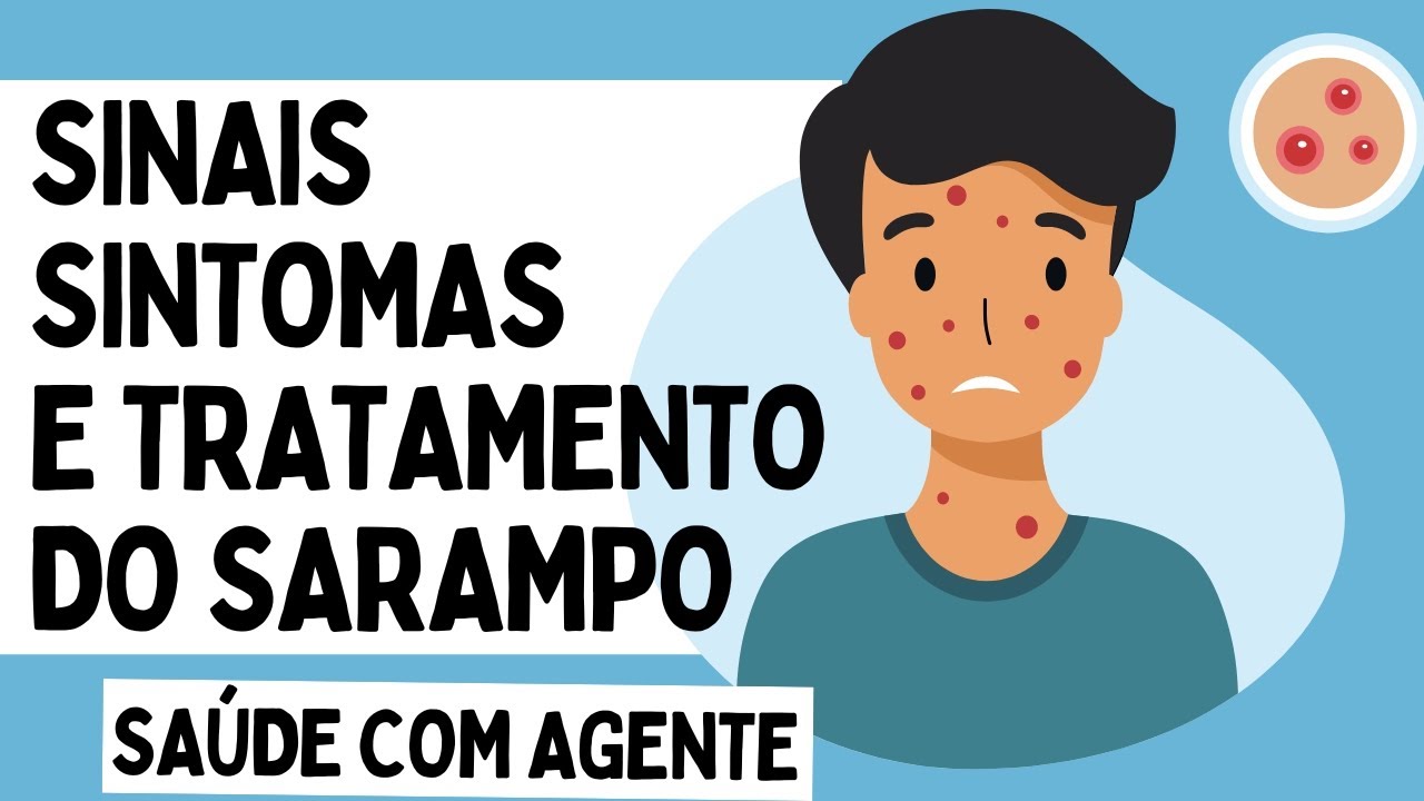 SARAMPO - Sinais, Sintomas e Tratamento - YouTube