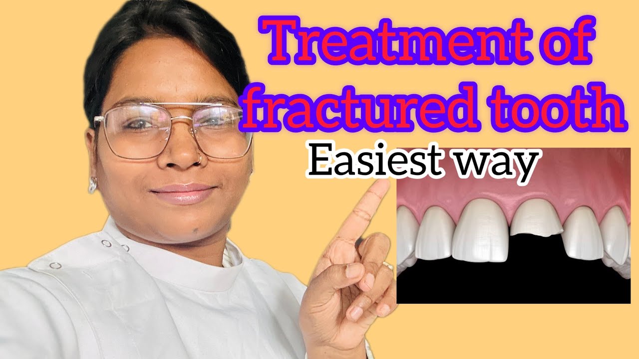 Treatment of fractured tooth - YouTube