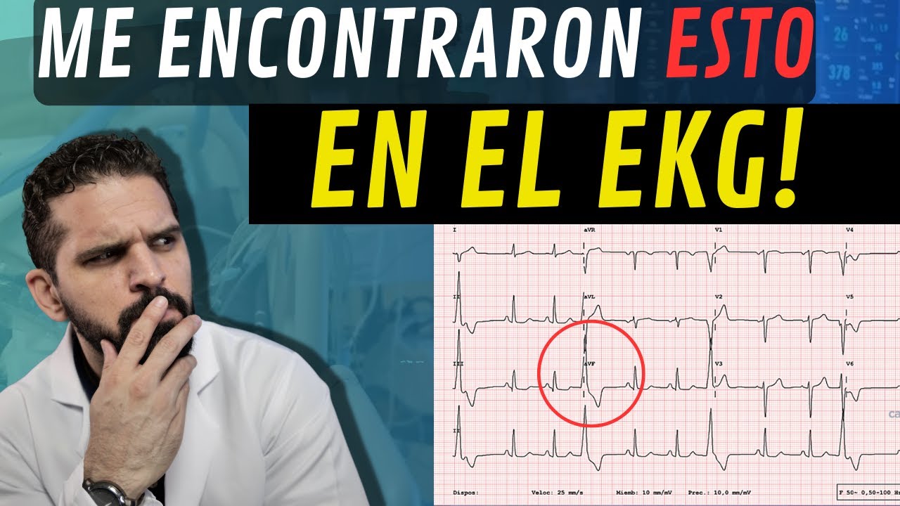 !Descifrando tu ECG! : Entendiendo los Resultados de tu ...