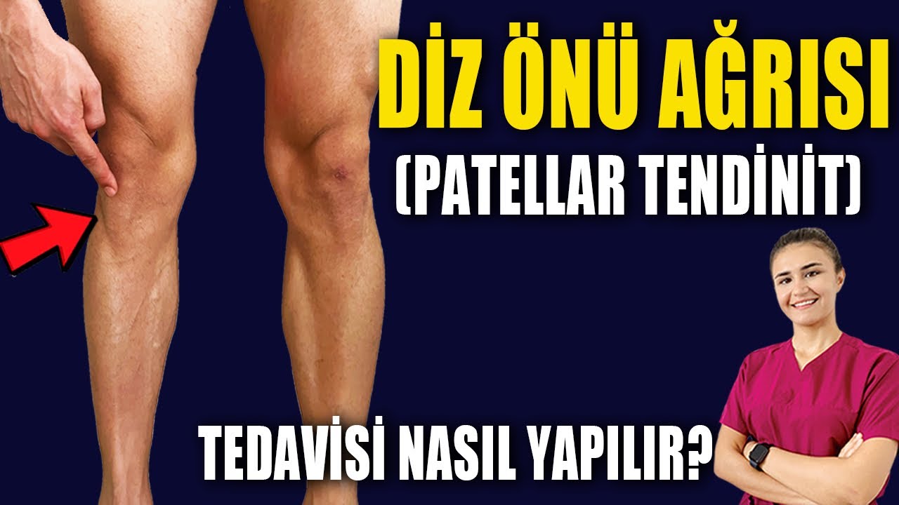 PATELLAR TENDİNİT TEDAVİSİ - YouTube