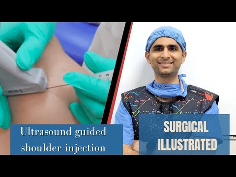 Ultrasound guided shoulder injection for frozen shoulder - YouTube