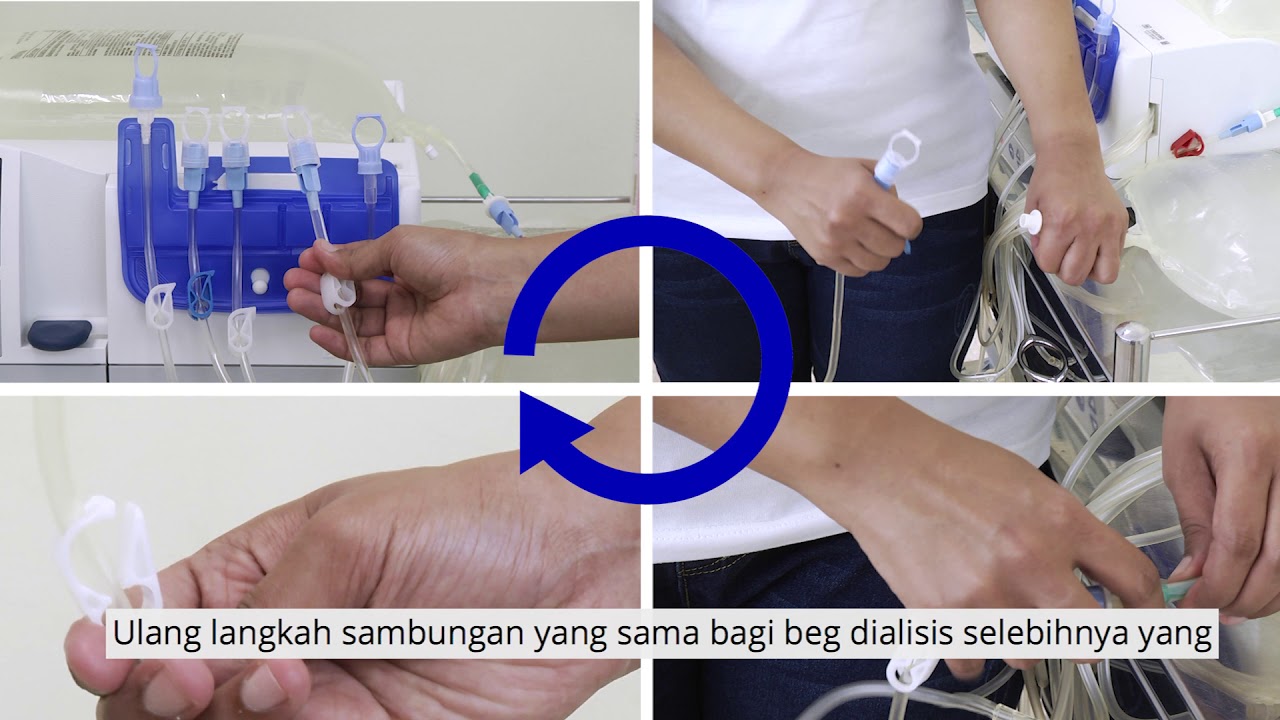 Automated Peritoneal Dialysis (APD) Step-By-Step Guide - (Malay ...