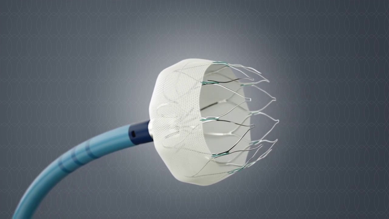 Doug Borg - Watchman Device - YouTube