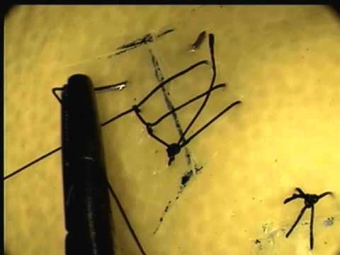 Continuous locking suture - YouTube