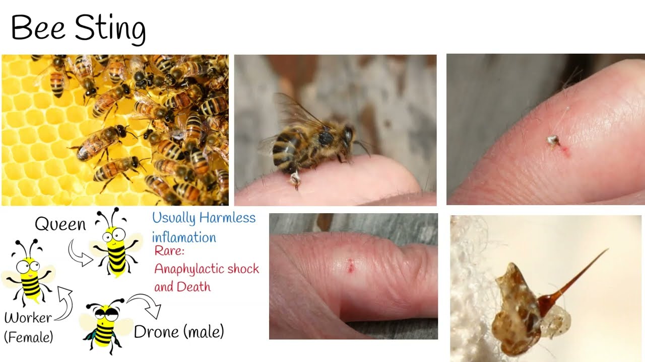 Drone Bee Stinger