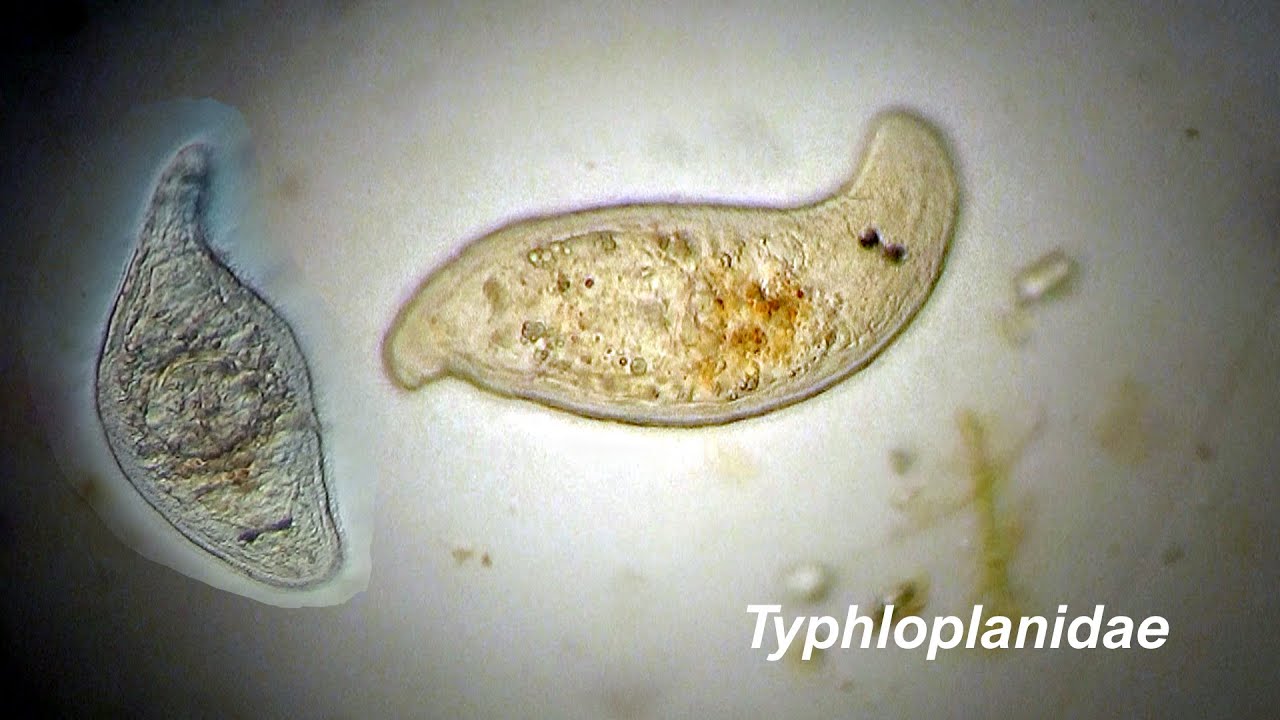 Typhloplanidae - YouTube