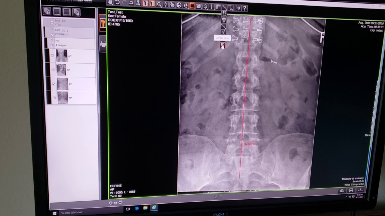 Pacific X-ray Technologies Training Video#3 - YouTube