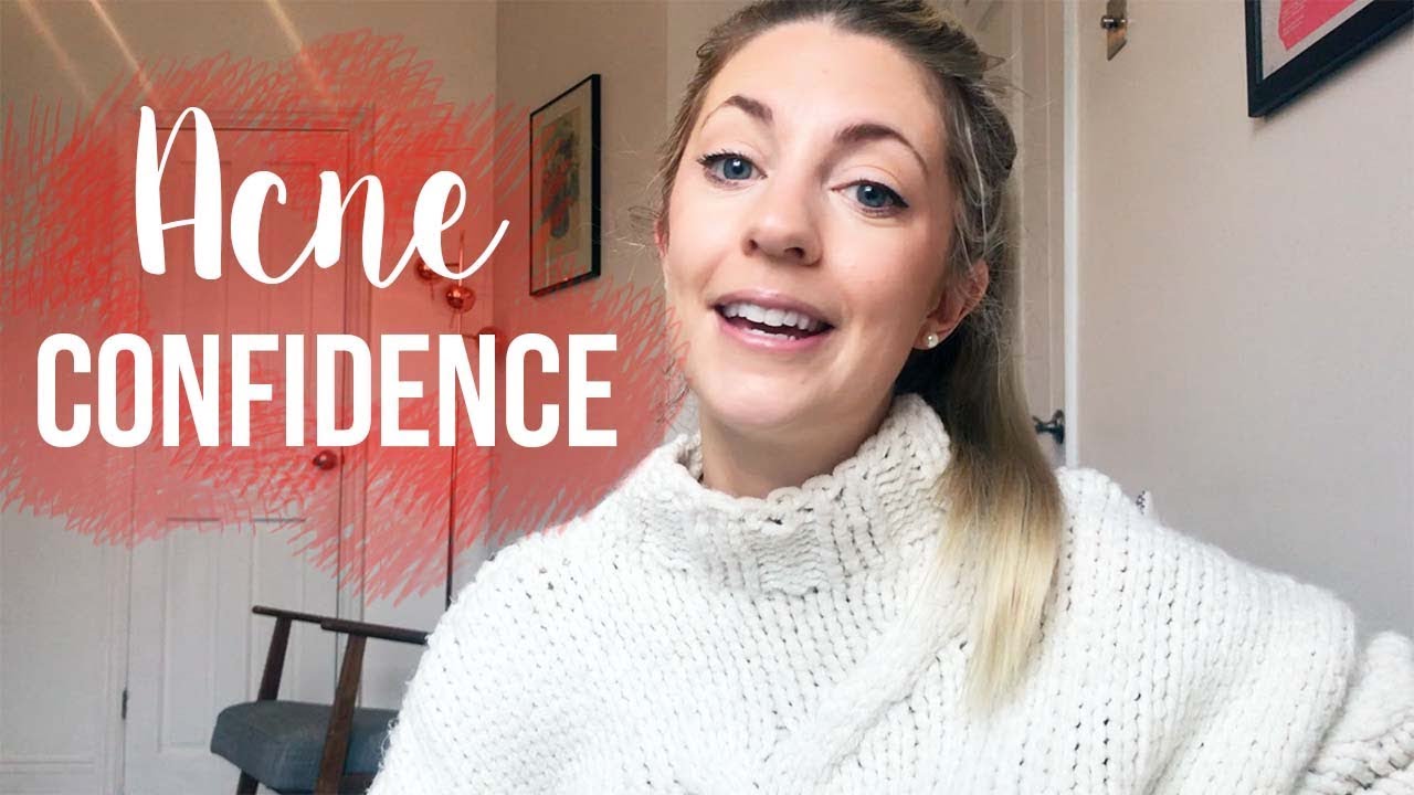 HOW TO HAVE CONFIDENCE WITH ACNE - YouTube