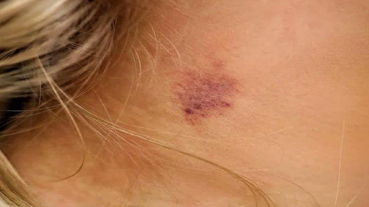 best trick to give someone a hickey - YouTube