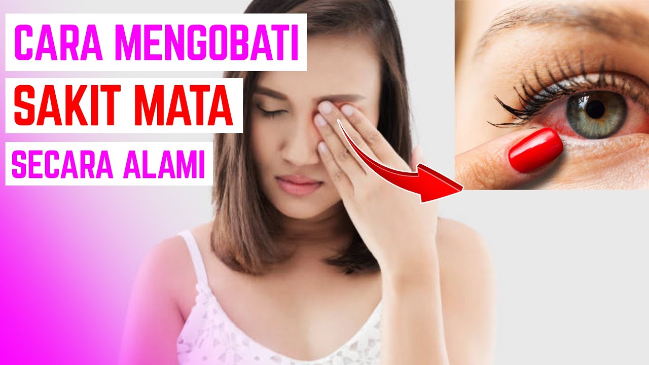 SAKIT MATA! CARA MENGOBATI MATA MERAH SECARA ALAMI - YouTube