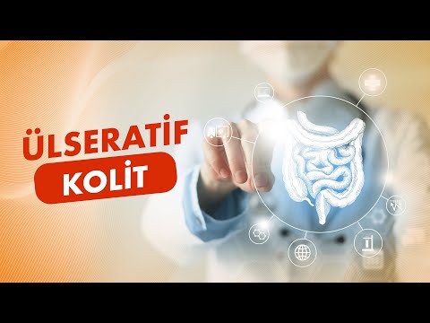 Ülseratif Kolit Nedir? Belirtileri, Tedavi Yöntemleri ve Daha Fazlası | Prof. Dr. Murat Sarıkaya