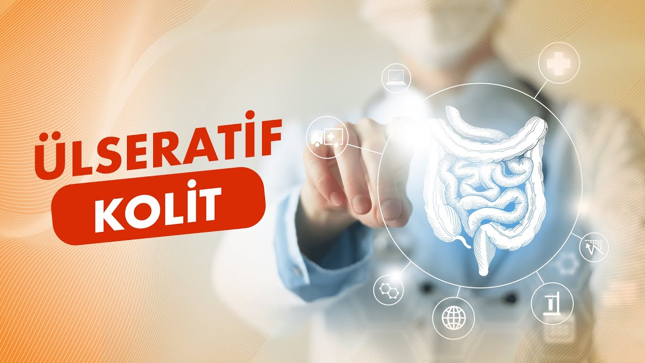 Ülseratif Kolit Nedir? Belirtileri, Tedavi Yöntemleri ve Daha Fazlası ...