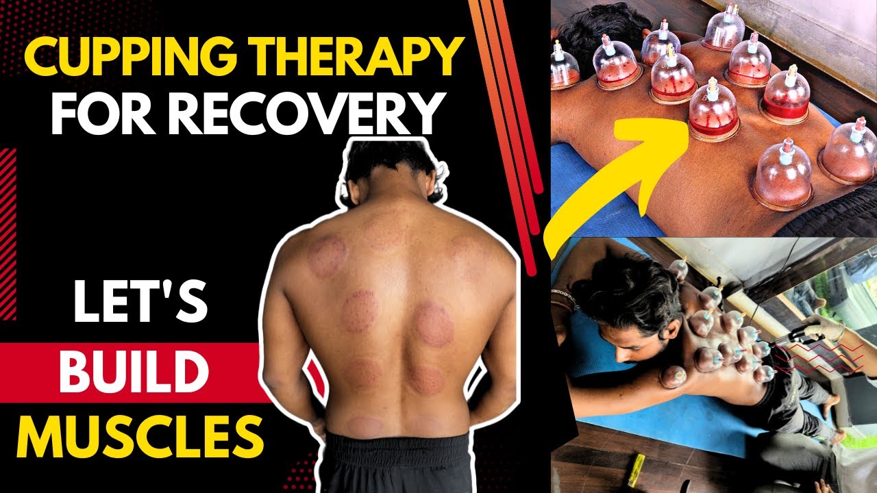 Benifits Of Cupping therapy || Hijama Therapy || This Is How We Build ...