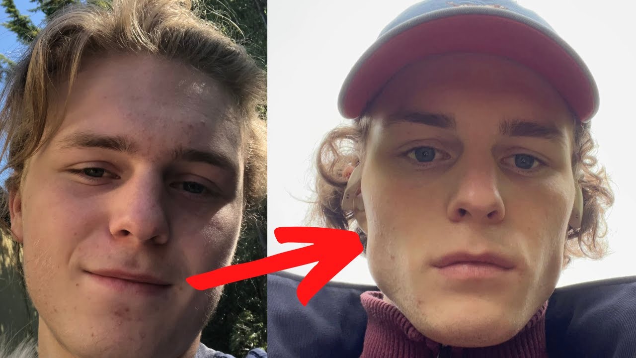 How To 10x Your Mewing Results Using This One Secret - YouTube