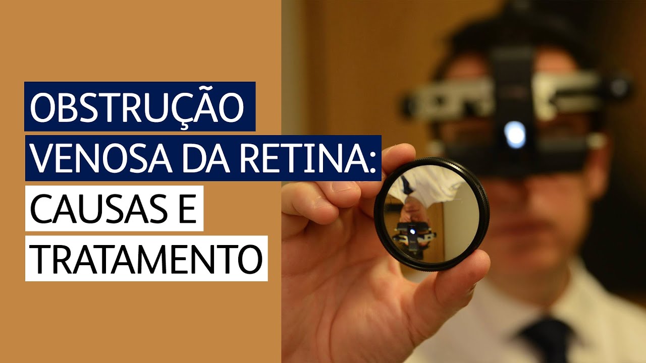 Obstrução venosa da retina: causas e tratamento - YouTube