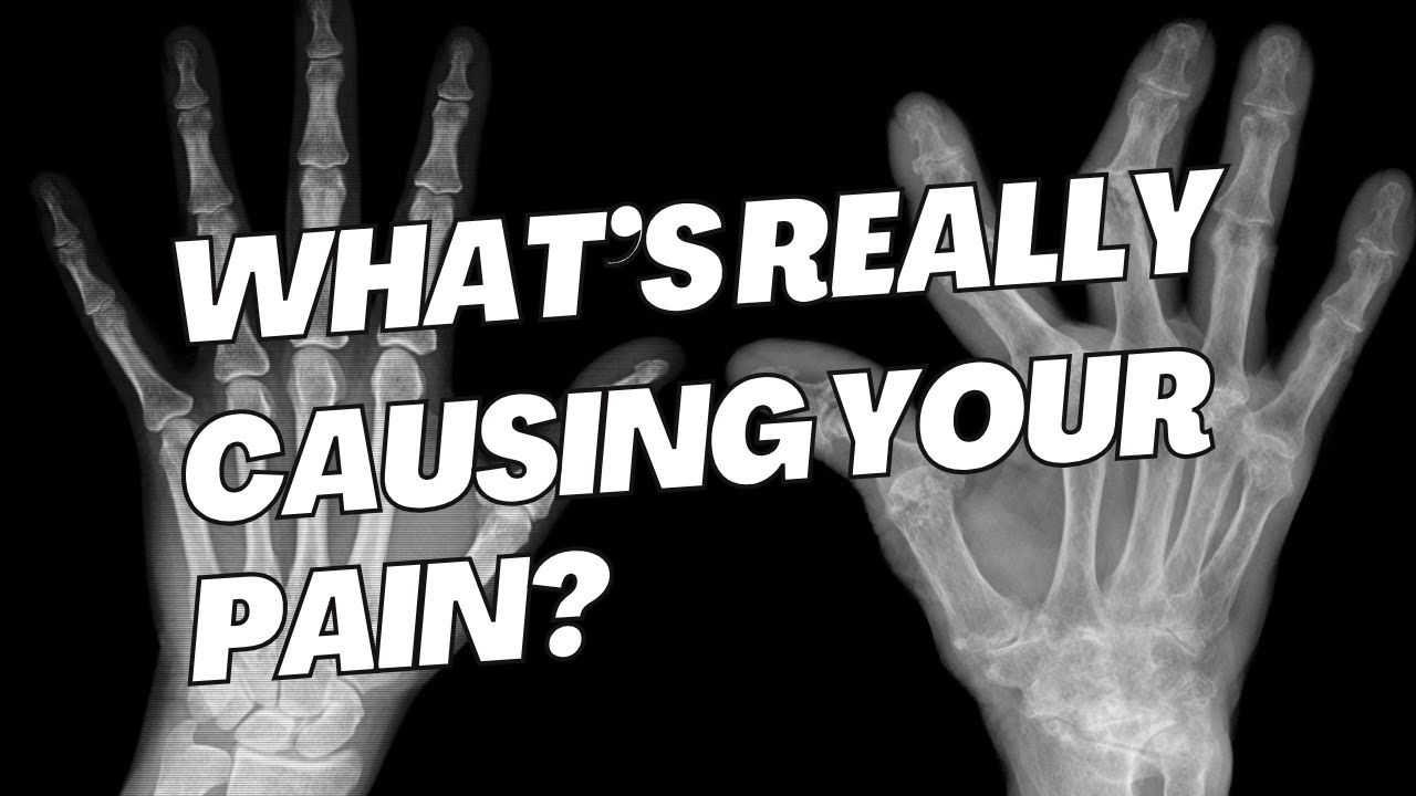 Swollen Joints? This Distinction Could Save Your Mobility - YouTube