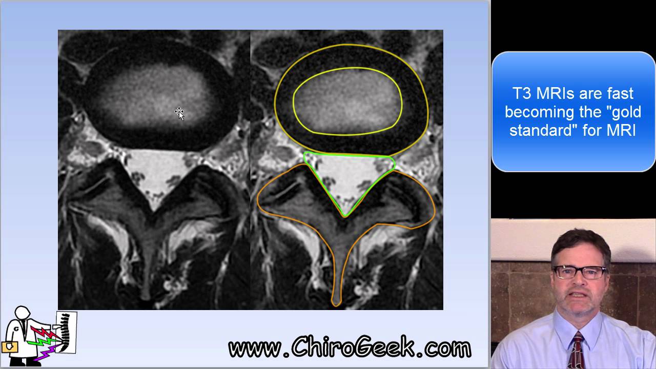 Dr. Gillard Lectures on Lumbar Disc Herniation / Protrusion. Part I of ...
