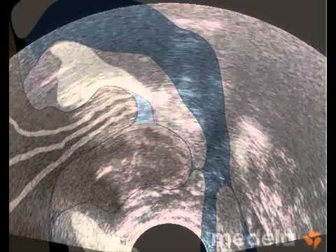 Ultrasound of an infant suck cycle - slow motion with overlay