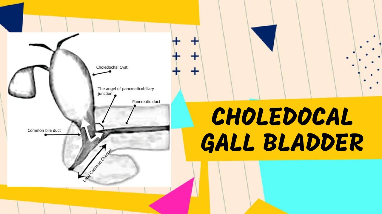 19 Choledocal cyst and Gall Bladder - YouTube