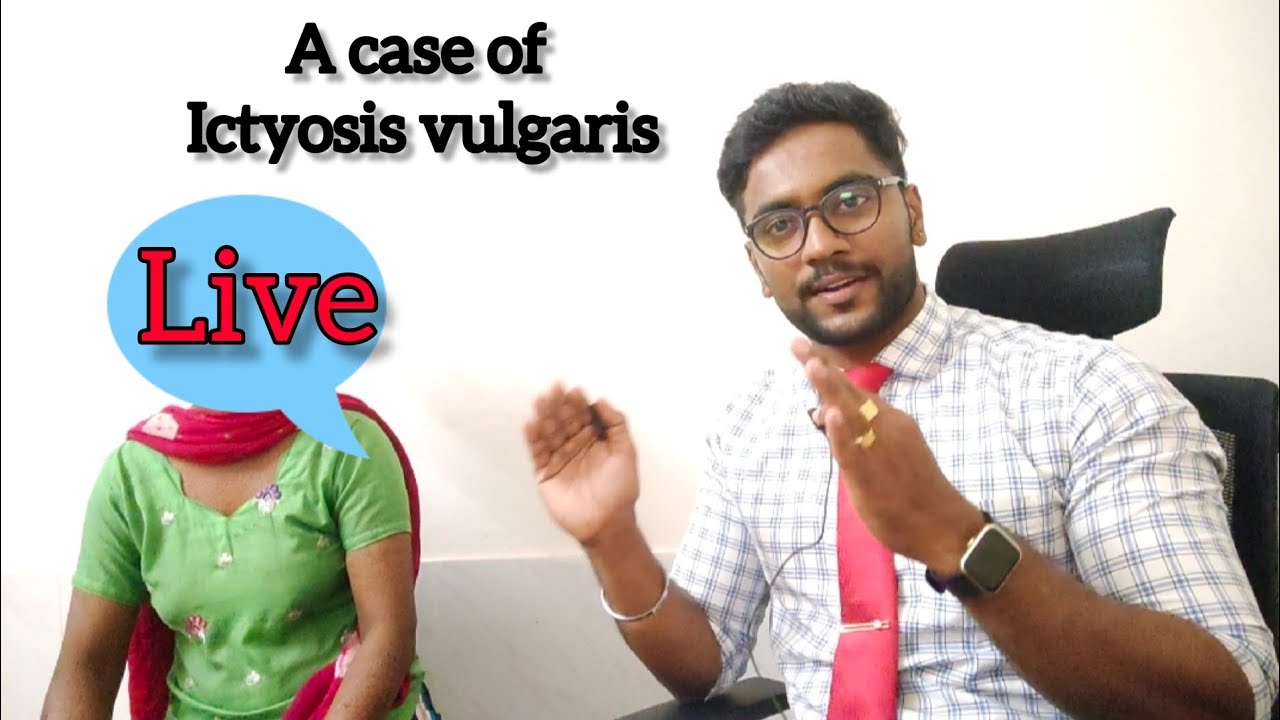 Ichthyosis Vulgaris/ Dry skin/ Fish scaly skin disease #skincare # ...