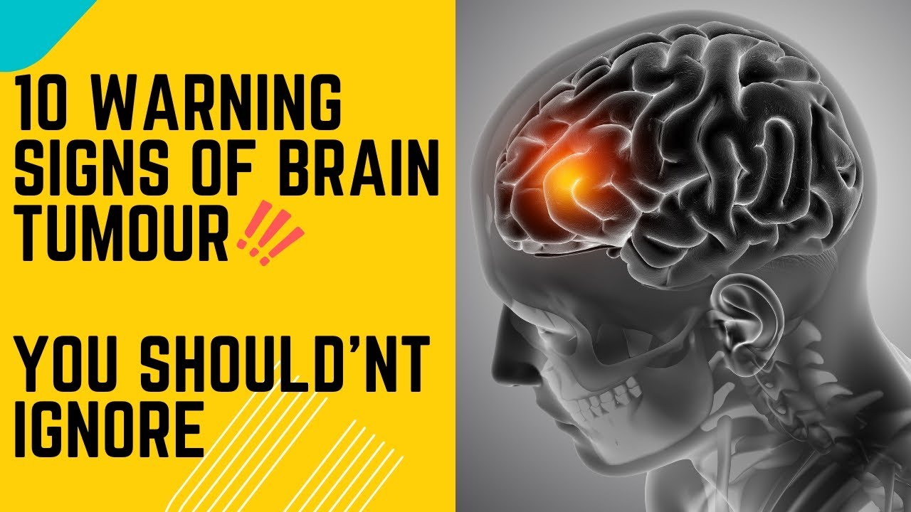Top 10 Warning Signs Of Brain Tumours You Need To Know - Get Informed ...