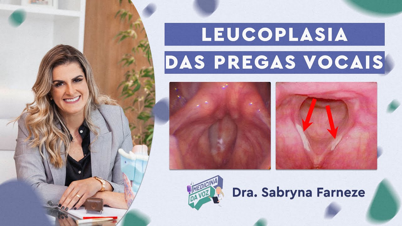 Leucoplasia das cordas vocais - YouTube