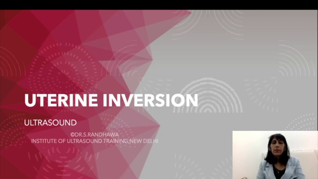 INVERSION UTERUS ULTRASOUND - YouTube