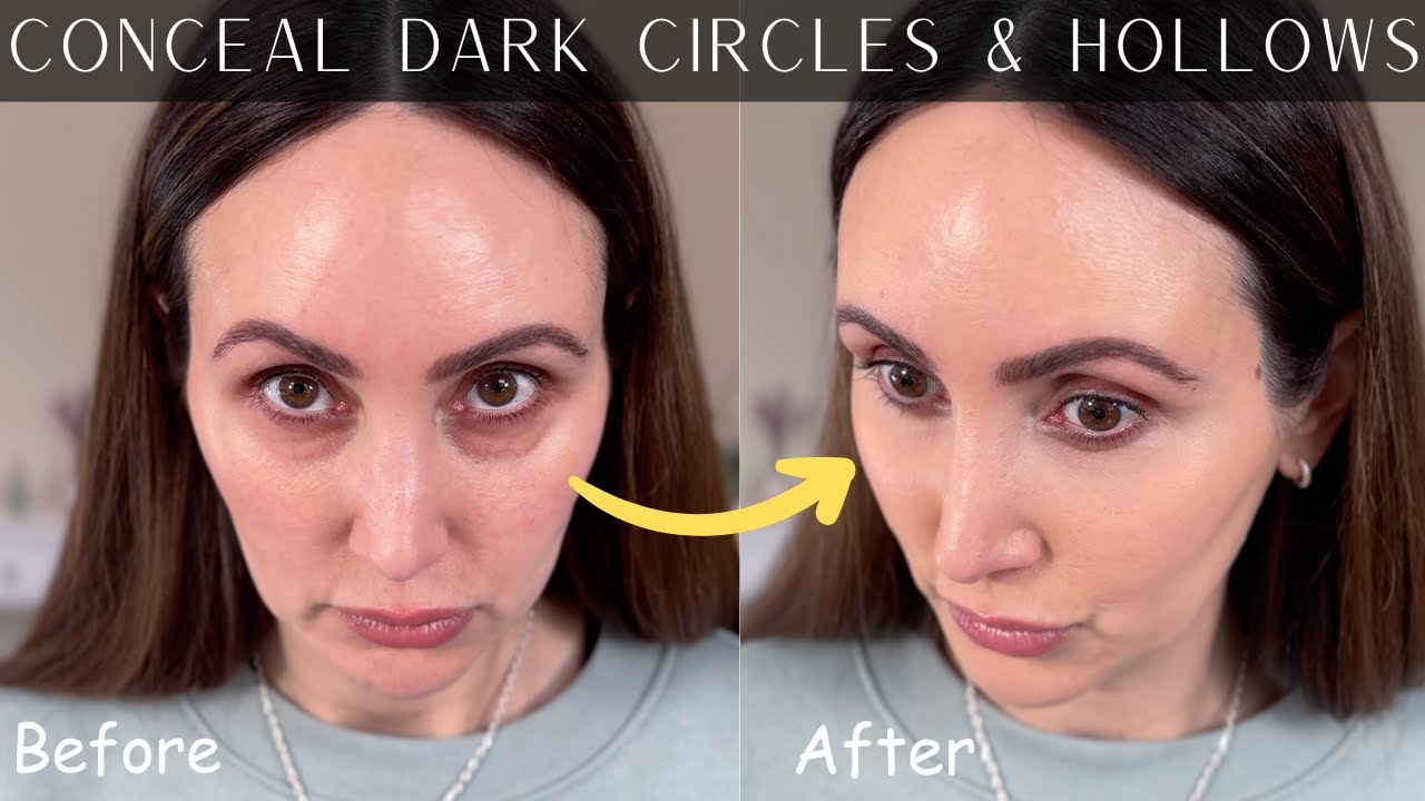 How To CONCEAL Under EYE HOLLOWS DARK CIRCLES A Simple Tutorial how-to-conceal-under-eye-hollows-dark-circles-a-simple-tutorial