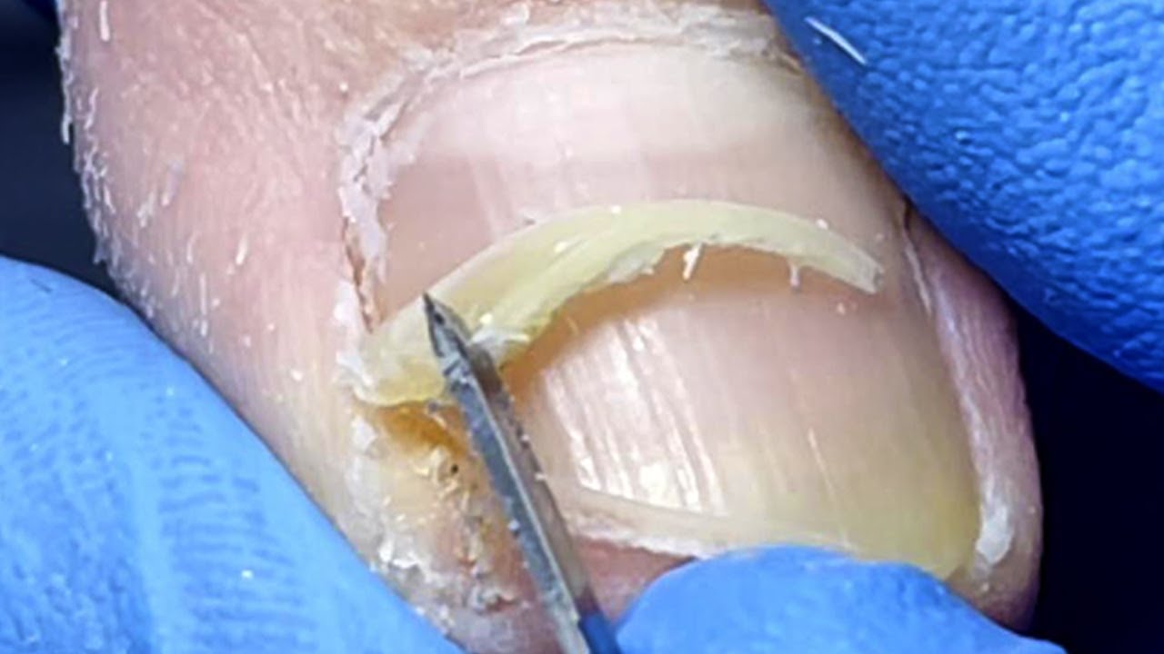 Get a neat pedicure and cut your toenails into the right shape # ...