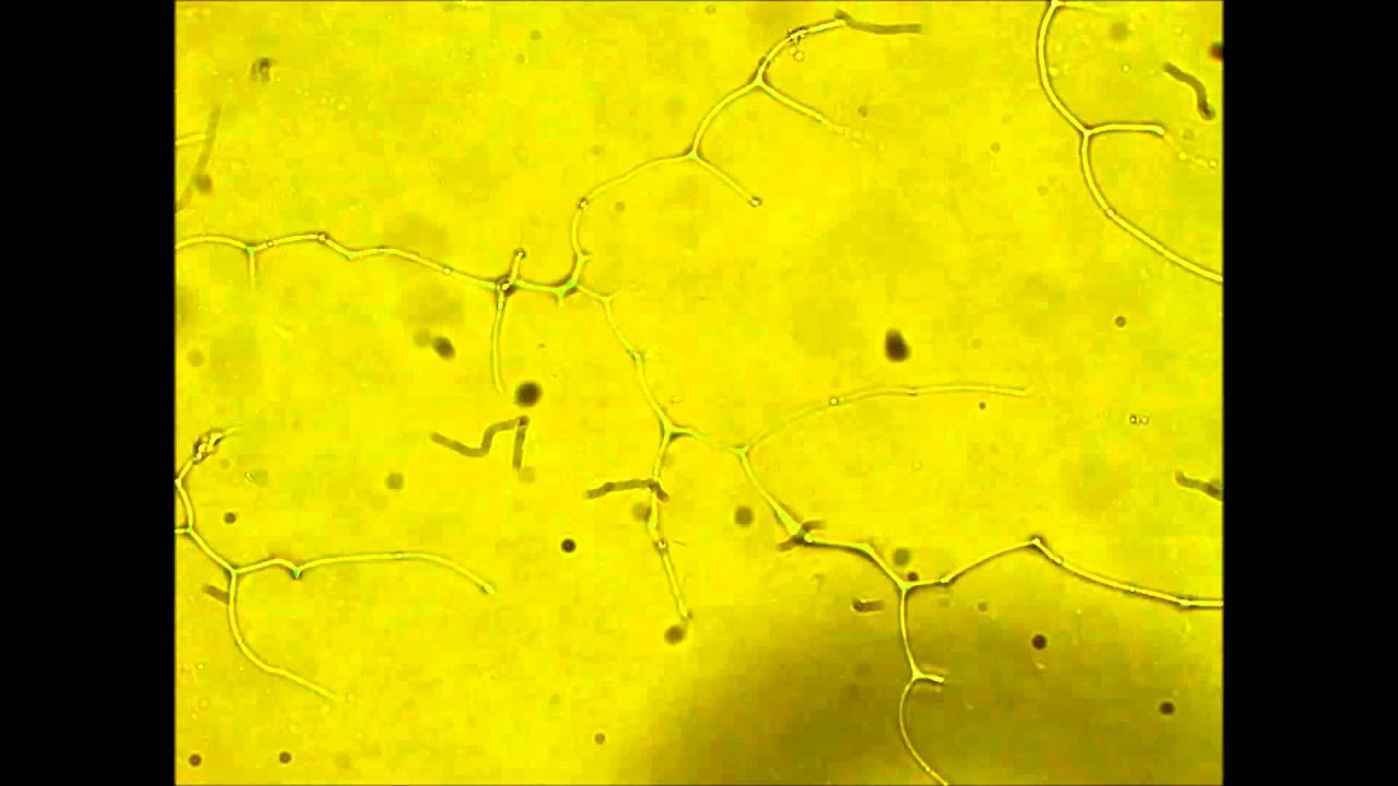 Spit Sample Day 11 - Morgellons@100/200/400/1000xMagnification+Resample ...