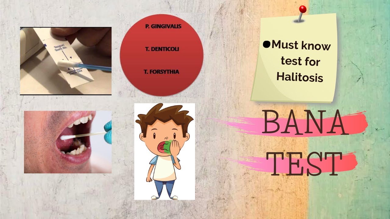 BANA TEST FOR HALITOSIS | PERIO | DENTO FRIEND - YouTube