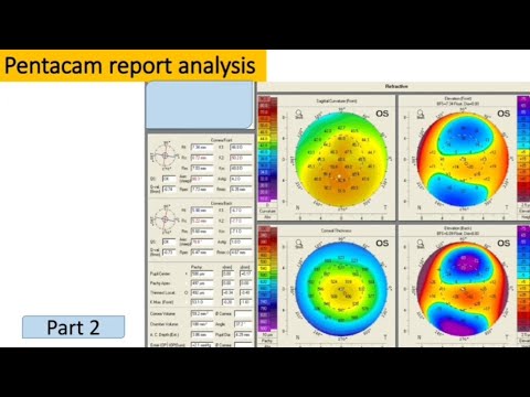 Pentacam report analysis - YouTube