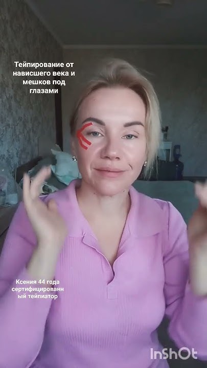 #тейпы #тейпирование #тейпированиелица от нависшего века и мешков под ...