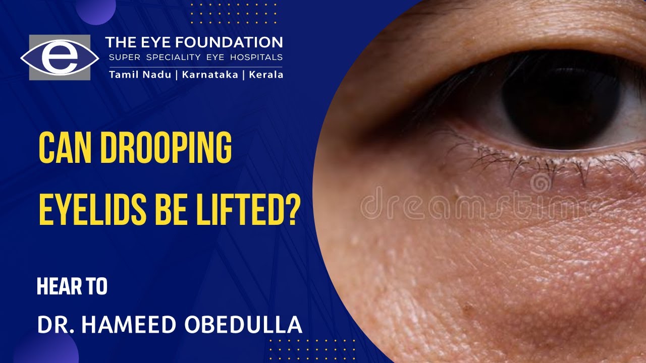 Can drooping eyelids be lifted? | Ptosis | Common Eye Conditions | The ...