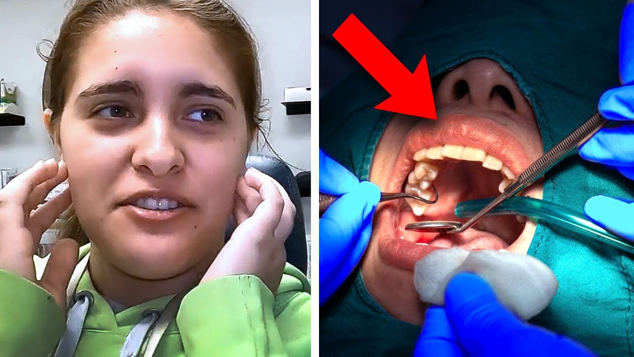 Getting Surgery done…How Surgery Works [Orthodontist Explains] - YouTube