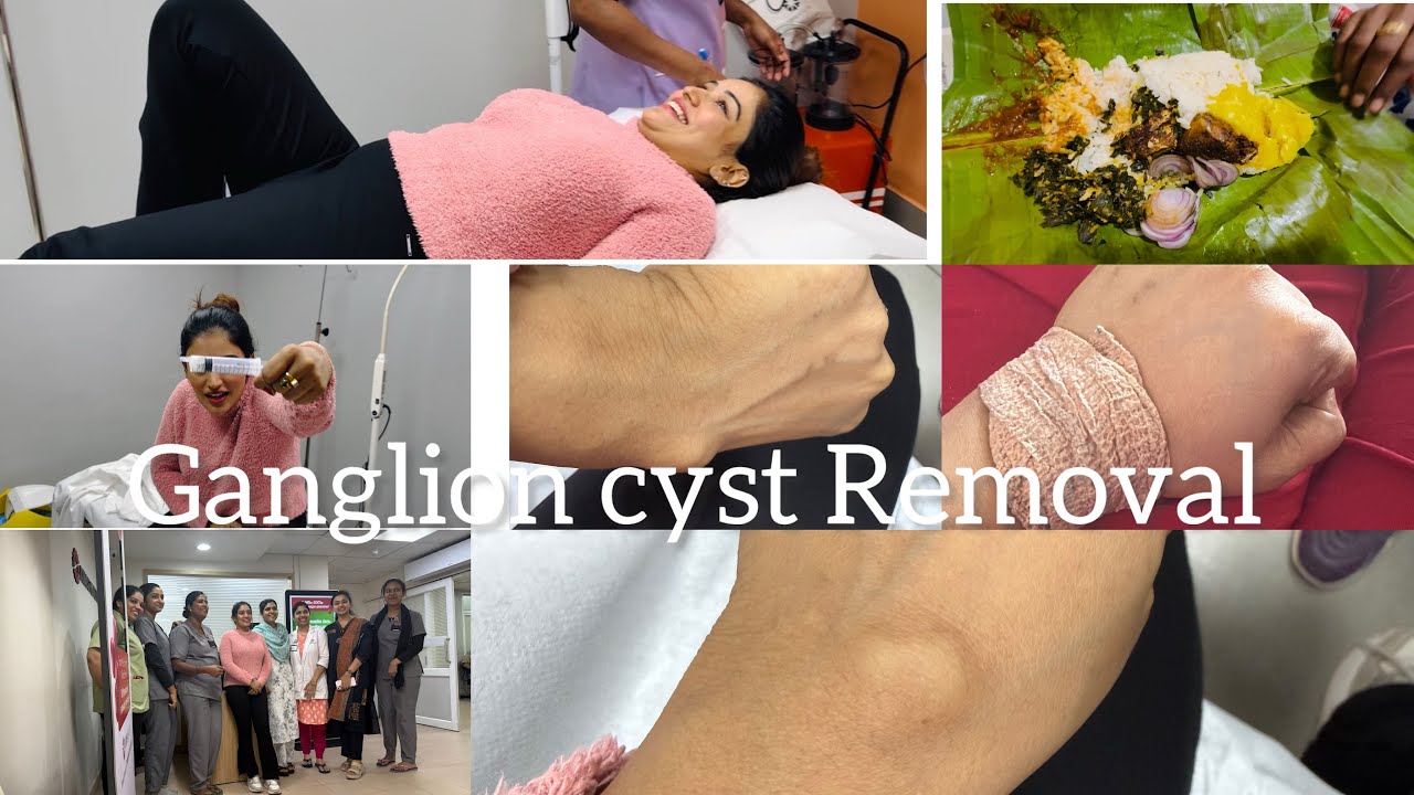 Oru Hospital vlog 🙂Ganglion cyst removal 🥺|Anumol | cyst removal ...