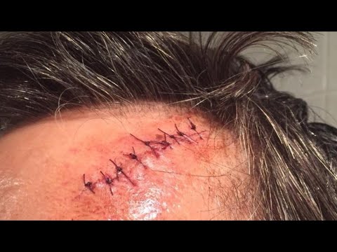 Videomu çəkib sonra təhvil verdilər | Əli Kərimli (ən son görüntülər)