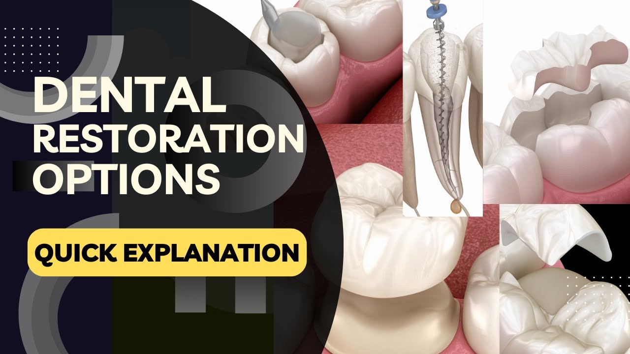 What are All Dental Restoration Options? Quickly Explained in a Few ...