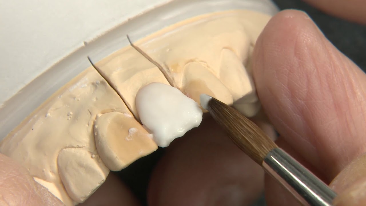 Die Build-up-Technik von Hitoshi Aoshima - YouTube