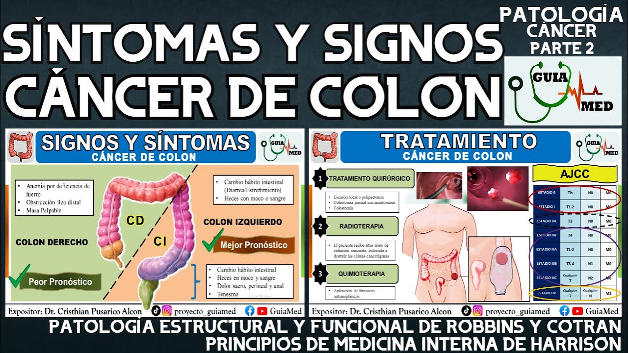 CÁNCER DE COLON SÍNTOMAS Y SIGNOS INICIALES | GuiaMed - YouTube