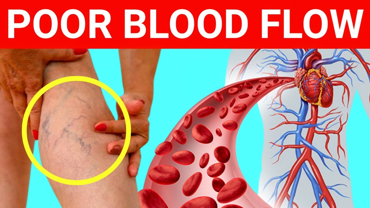 7 Causes Of Poor Blood Circulation | ( Blood Circulation ) - YouTube