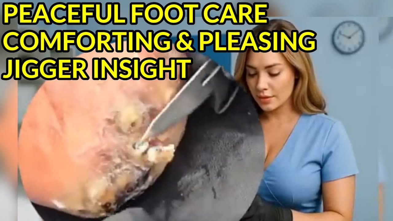 Peaceful Foot Care | Comforting & Pleasing Jigger Insight - YouTube