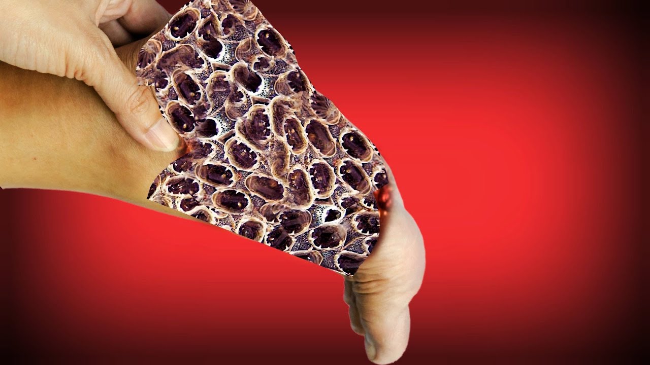 ASMR severely affected bryozoan trypophobia insect infected toe | ASMR ...