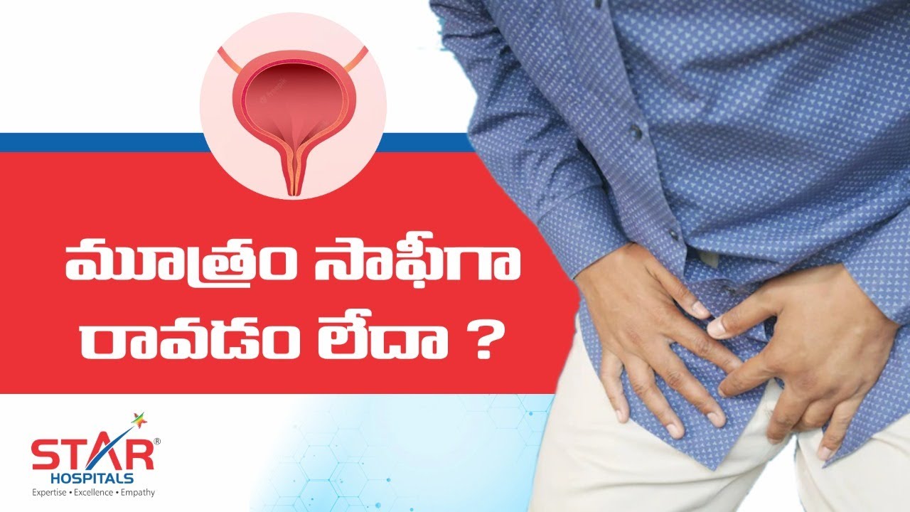 What Is The Cause Of Slow Urine Flow Dr Srinivas Gutta Star what-is-the-cause-of-slow-urine-flow-dr-srinivas-gutta-star
