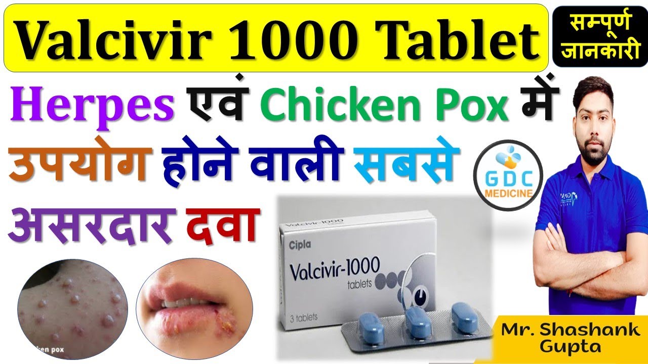 Valcivir 1000 Tablet की जानकारी | Herpes व Chicken Pox में उपयोगी # ...