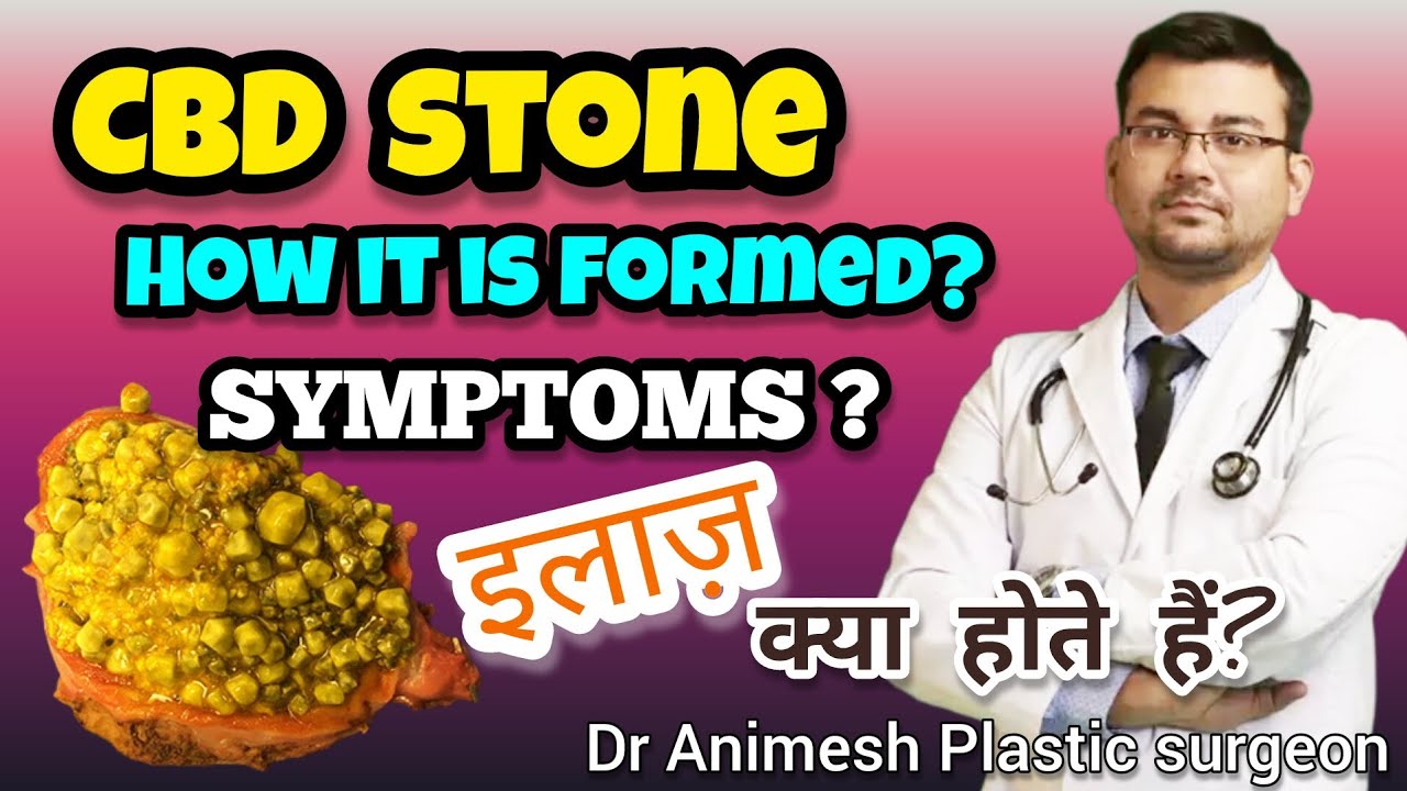 CBD stone से ख़तरनाक पीलिया हो सकता है, जाने इसके लक्षण और इलाज़! कहाँ ...
