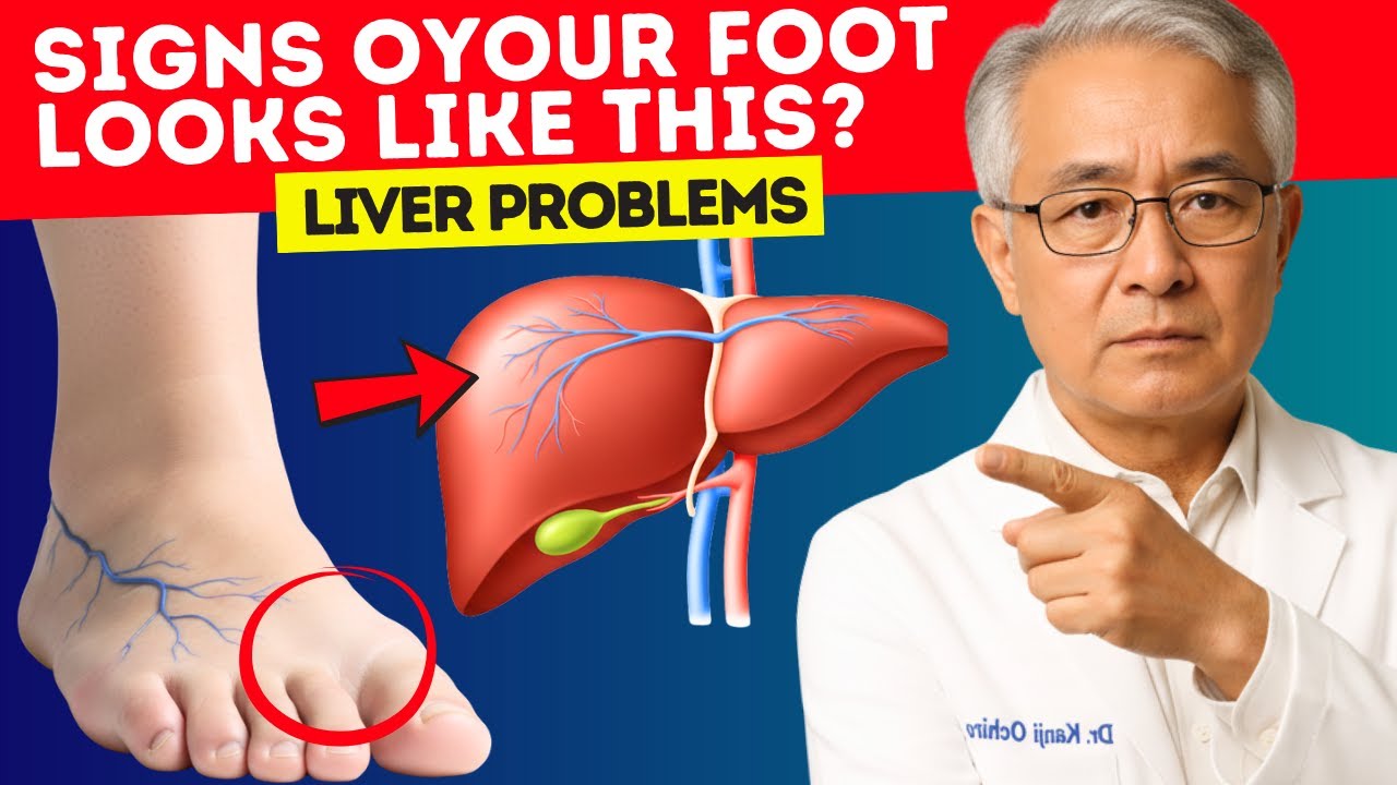 7 Signs in Your Feet Indicate Silent Liver Disease Identify Before It's ...