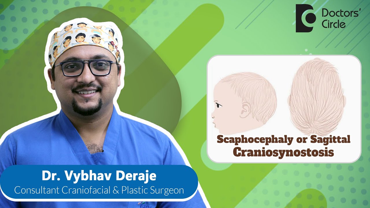 Long & Narrow Head In Baby|Scaphocephaly|Craniosynostosis #newborn -Dr ...