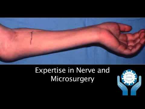 Roger Khouri, MD Miami Hand Surgeon - YouTube