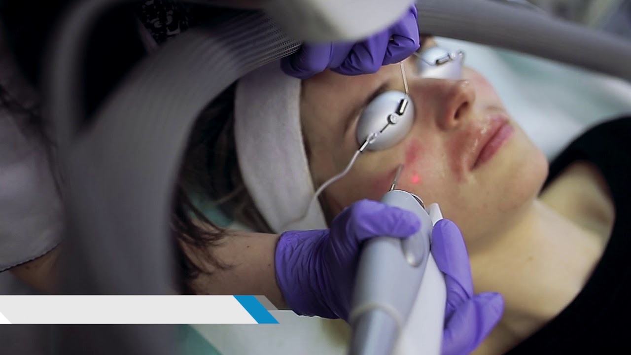 Medycyna Laserowa w ALLMEDICA - YouTube